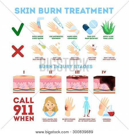 Skin Burn Injury Vector & Photo (Free Trial) | Bigstock