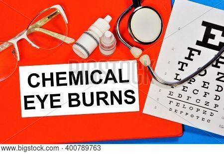 Chemical Eye Burn. Image & Photo (Free Trial) | Bigstock