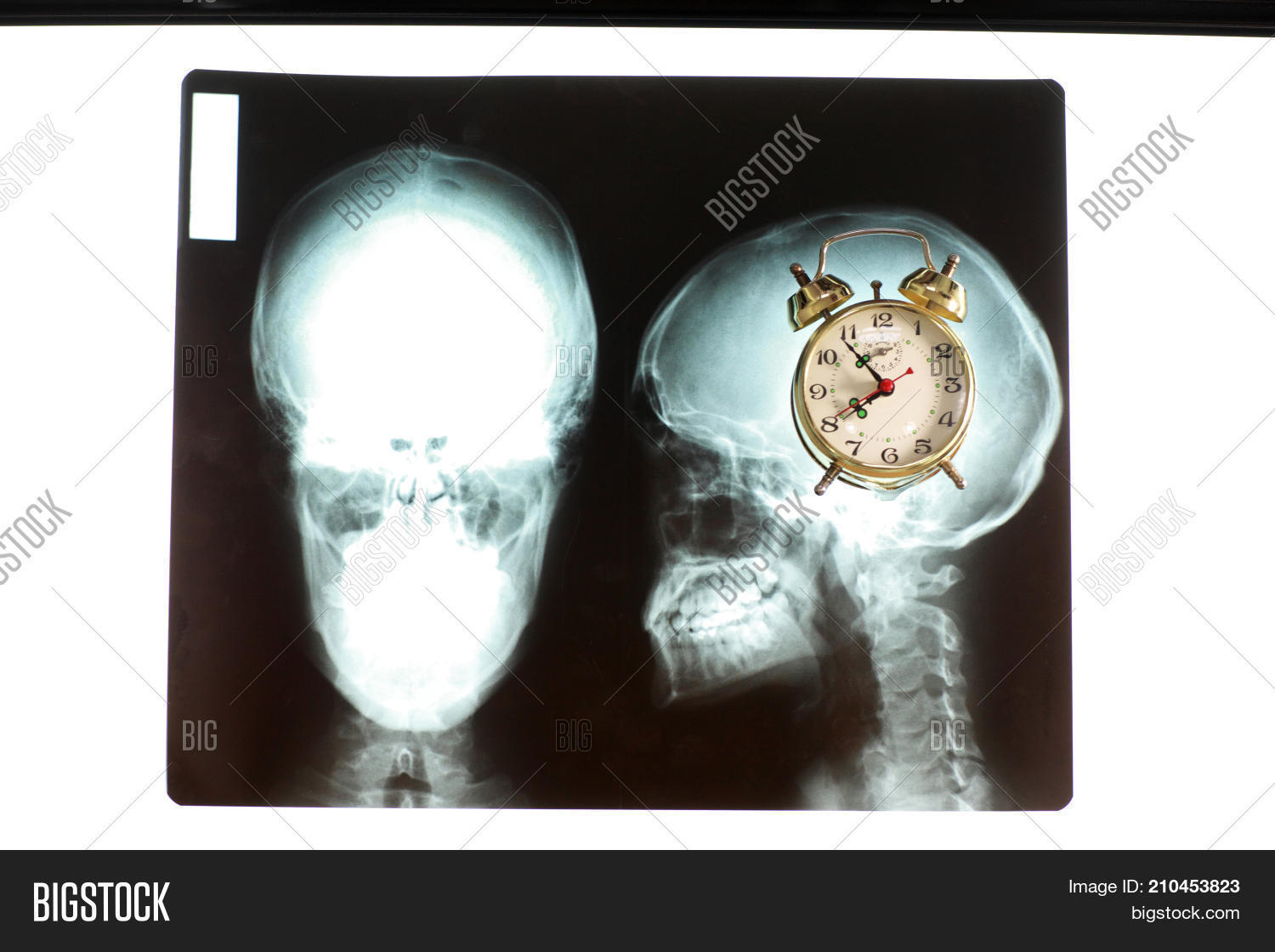 Alarm Clock Mind On X- Image & Photo (Free Trial) | Bigstock