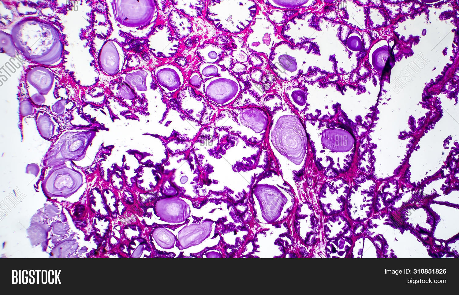 Histopathology Image & Photo (Free Trial) | Bigstock