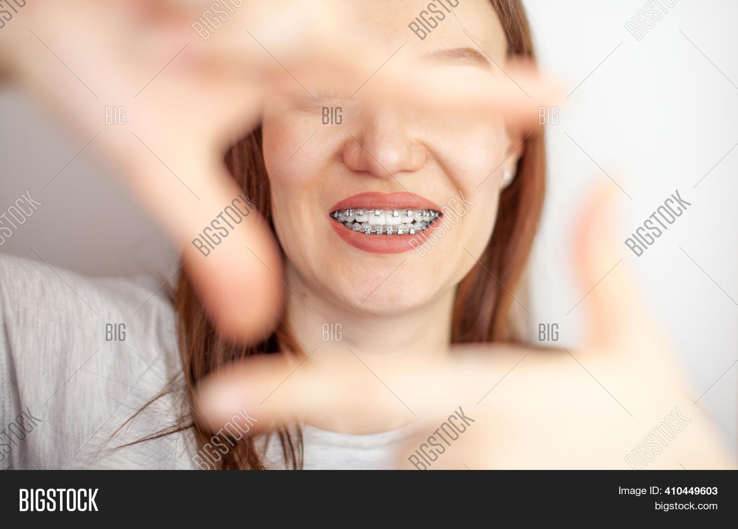 Beautiful Woman Braces Image And Photo Free Trial Bigstock