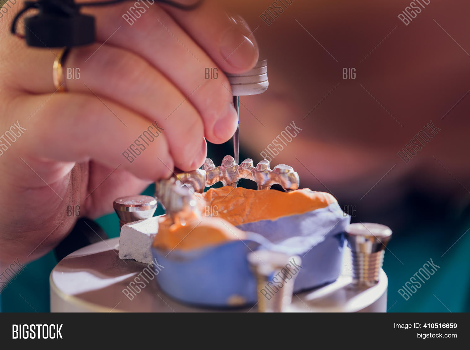 Process Making Dental Image & Photo (Free Trial) | Bigstock