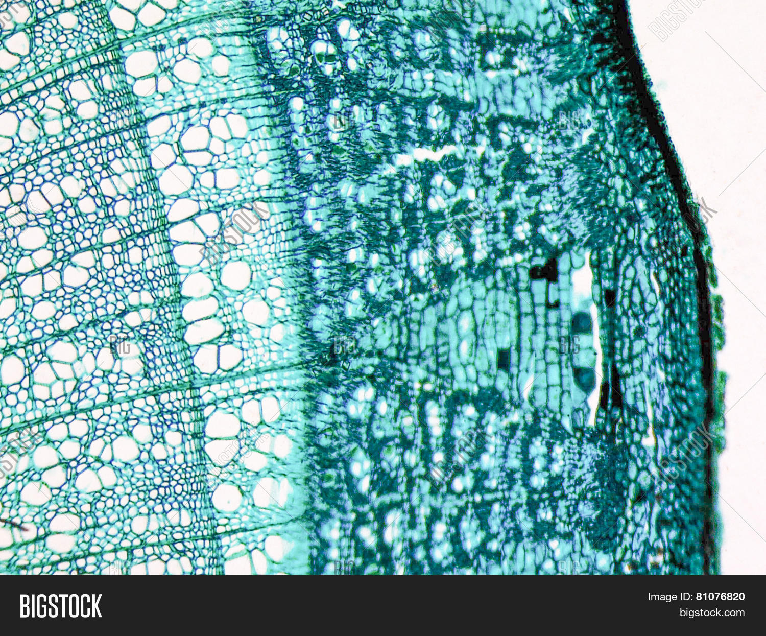 Tilia Stem Micrograph Image & Photo (Free Trial) | Bigstock