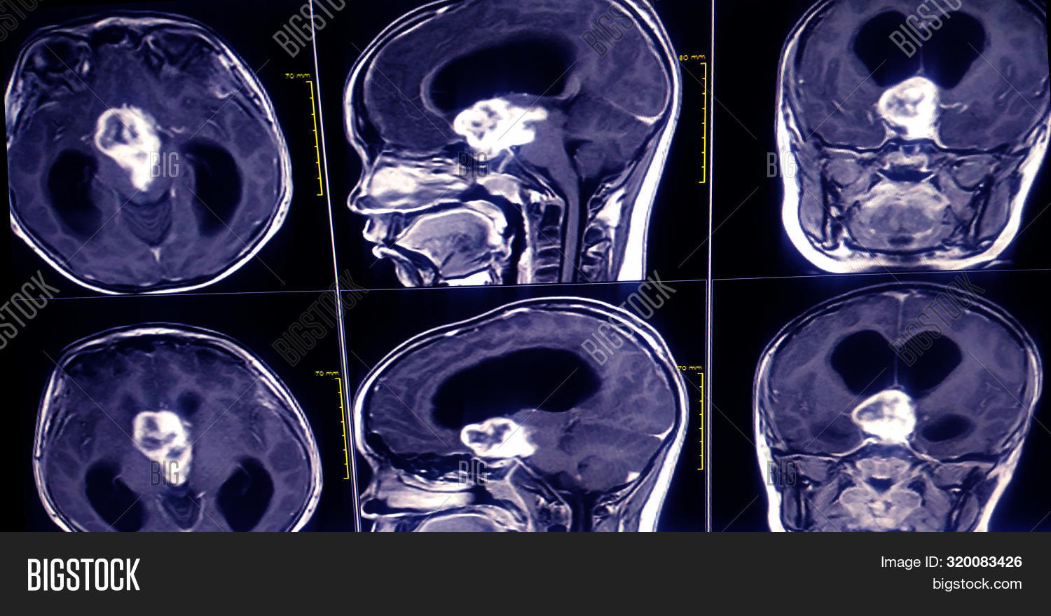 Mri Brain Orbits Boy Image & Photo (Free Trial) | Bigstock