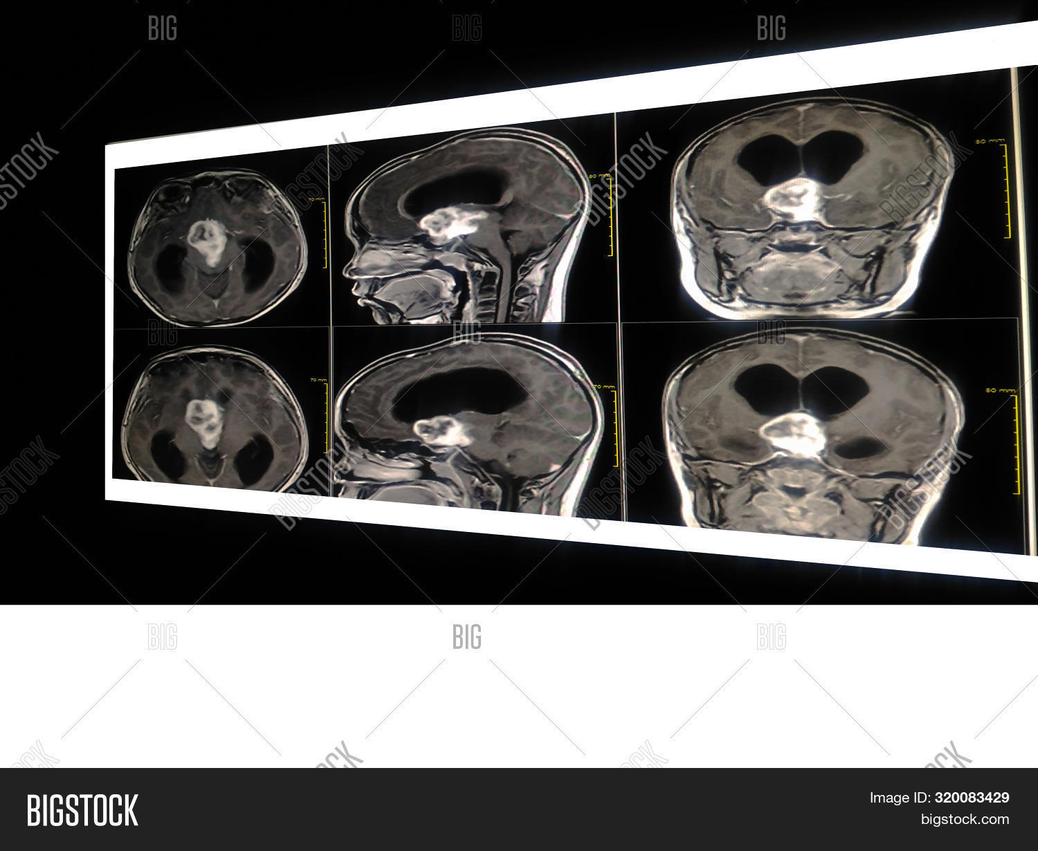 Mri Brain Orbits Boy Image & Photo (Free Trial) | Bigstock