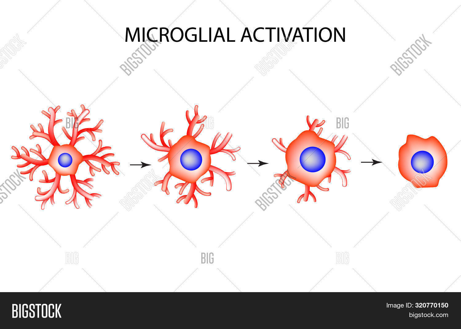 Activation Microglia. Image & Photo (Free Trial) | Bigstock