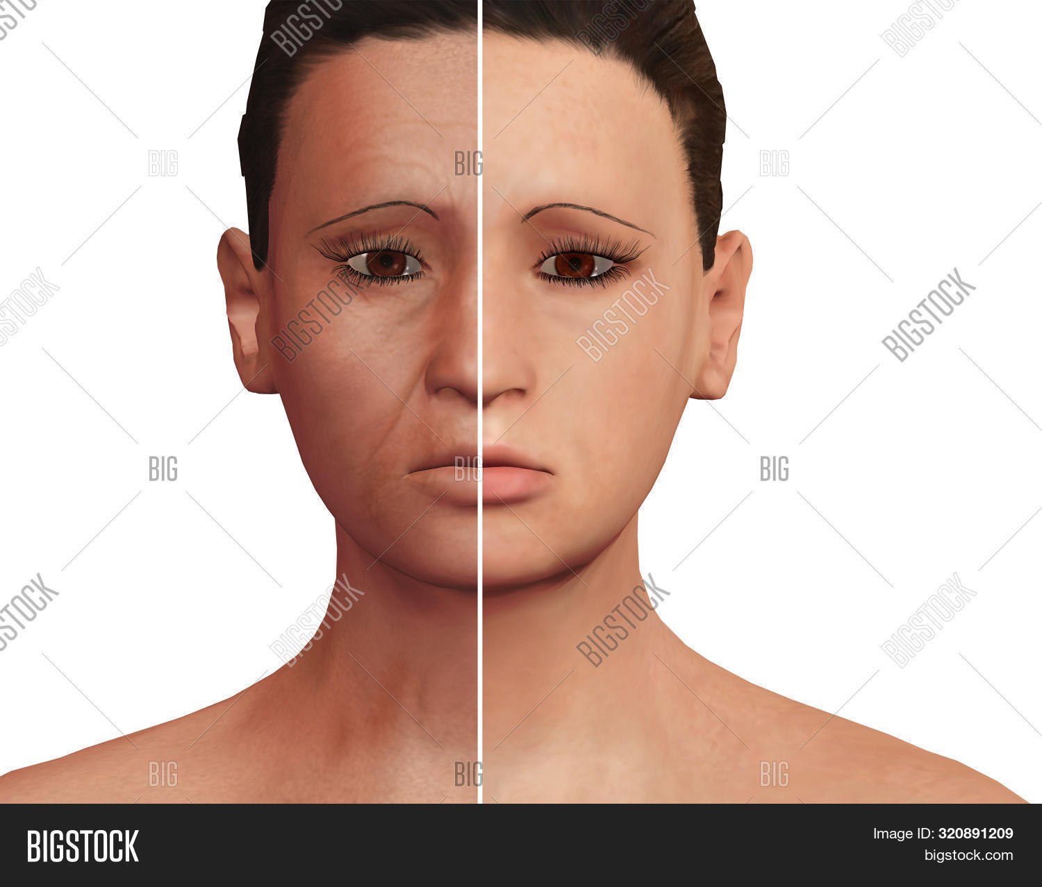 Before After Esthetic Image & Photo (Free Trial) | Bigstock