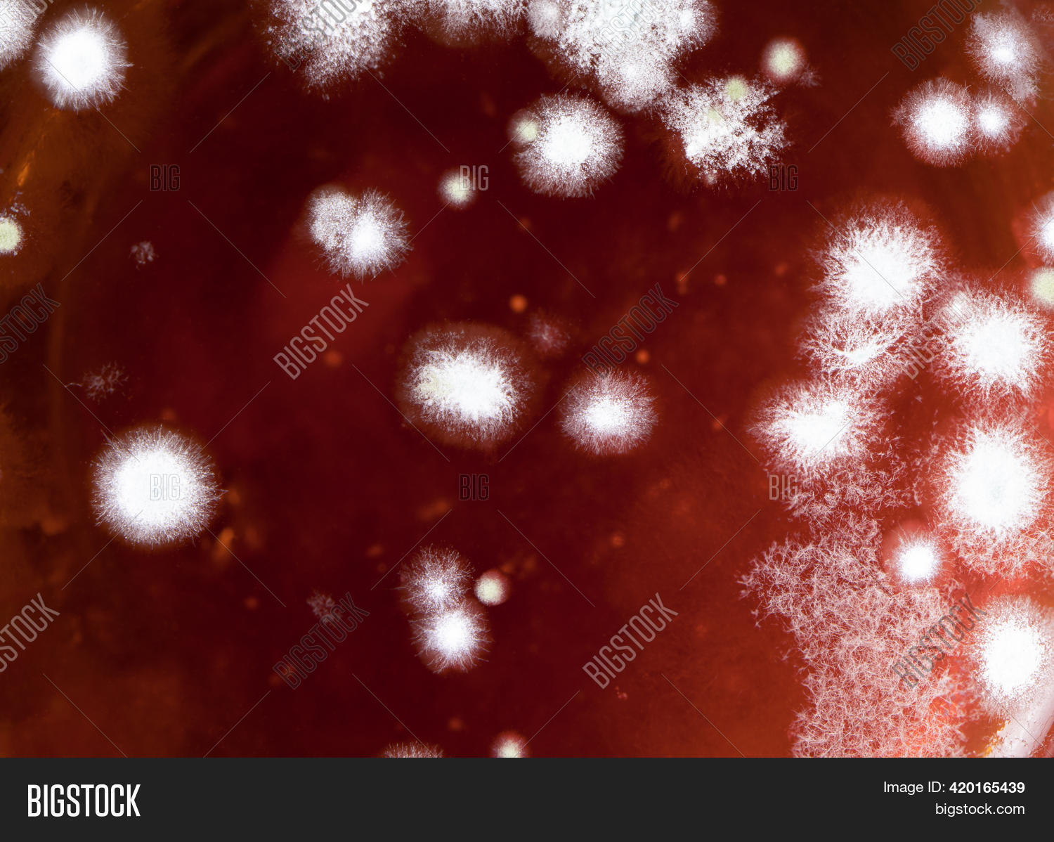 Fungal Spores Liquid. Image & Photo (Free Trial) | Bigstock