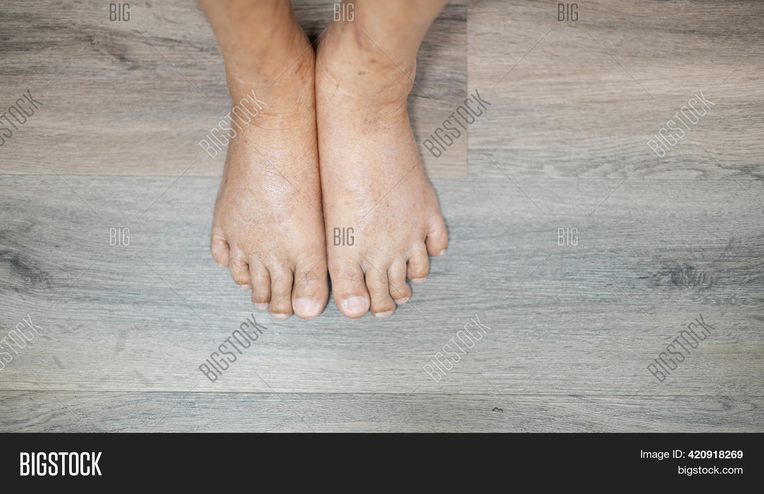 Feet Old Man Wrinkle Image & Photo (Free Trial) | Bigstock