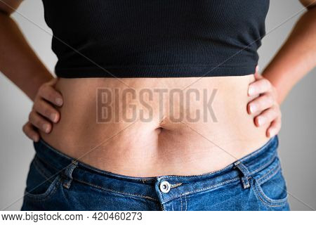 Fat Woman Belly Button Image & Photo (Free Trial) | Bigstock