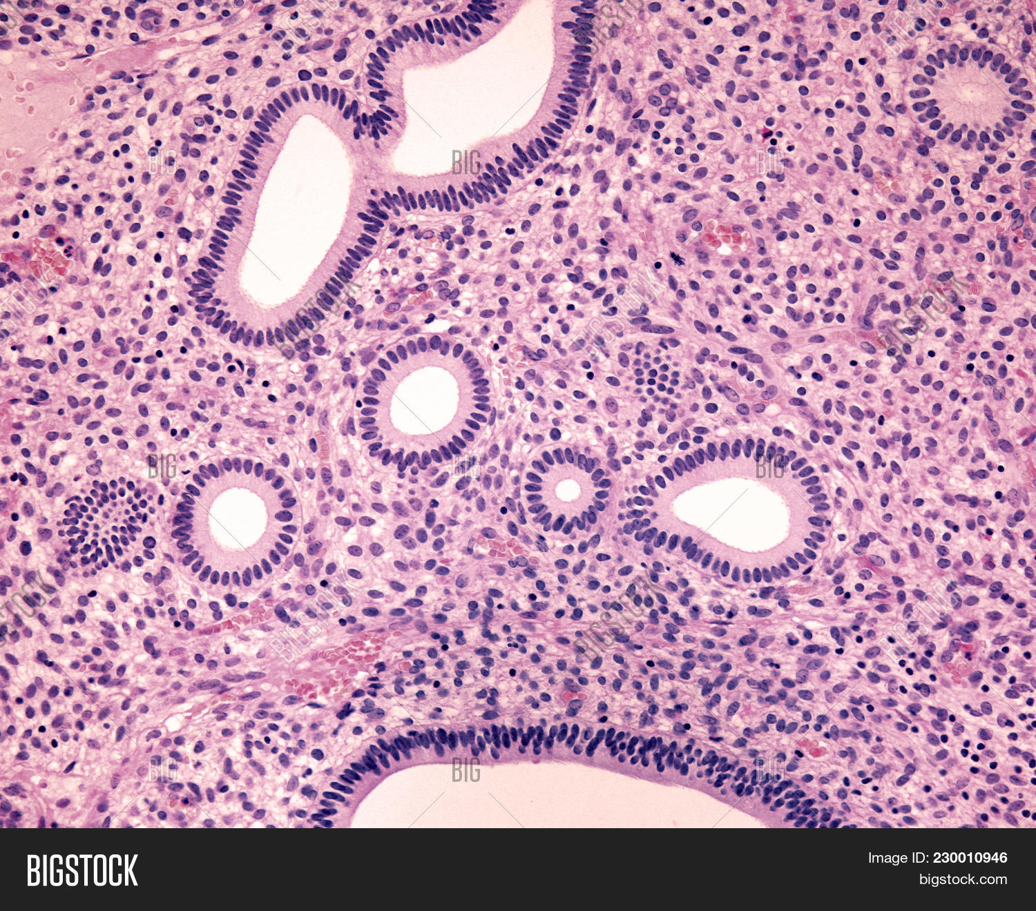 Human Endometrium. Image & Photo (Free Trial) | Bigstock