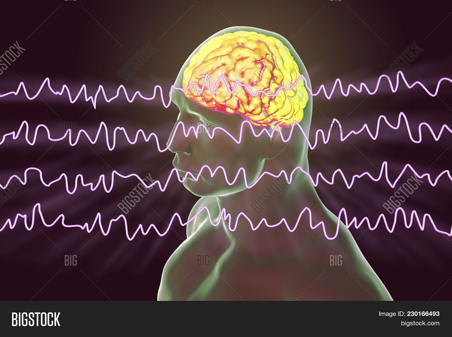 Eeg Image & Photo (Free Trial) | Bigstock
