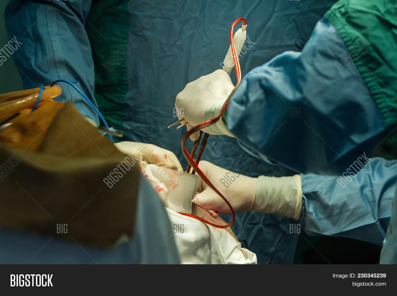 Operation Trepanation Image & Photo (Free Trial) | Bigstock