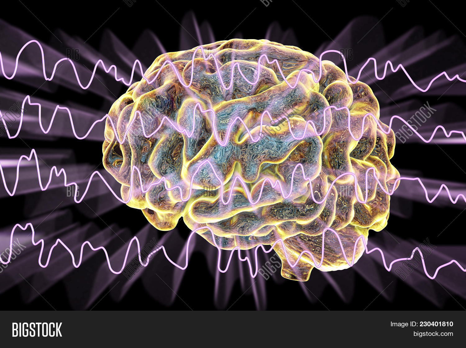 Eeg Image & Photo (Free Trial) | Bigstock