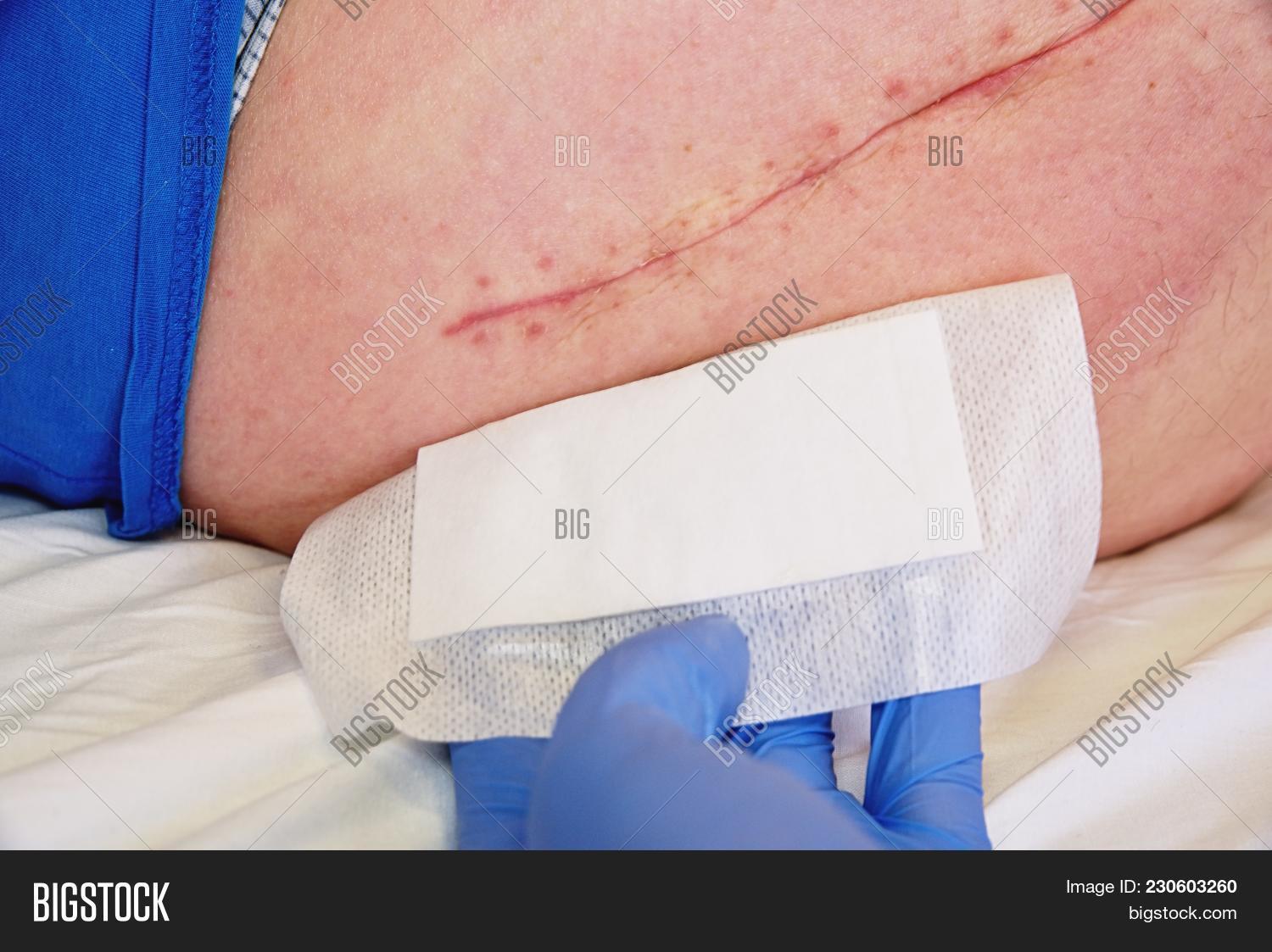 Wound On Skin. Body Image & Photo (Free Trial) | Bigstock