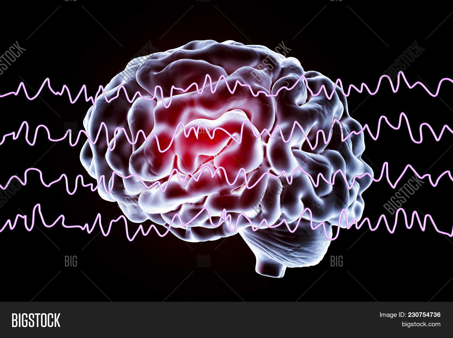 Eeg Image & Photo (Free Trial) | Bigstock