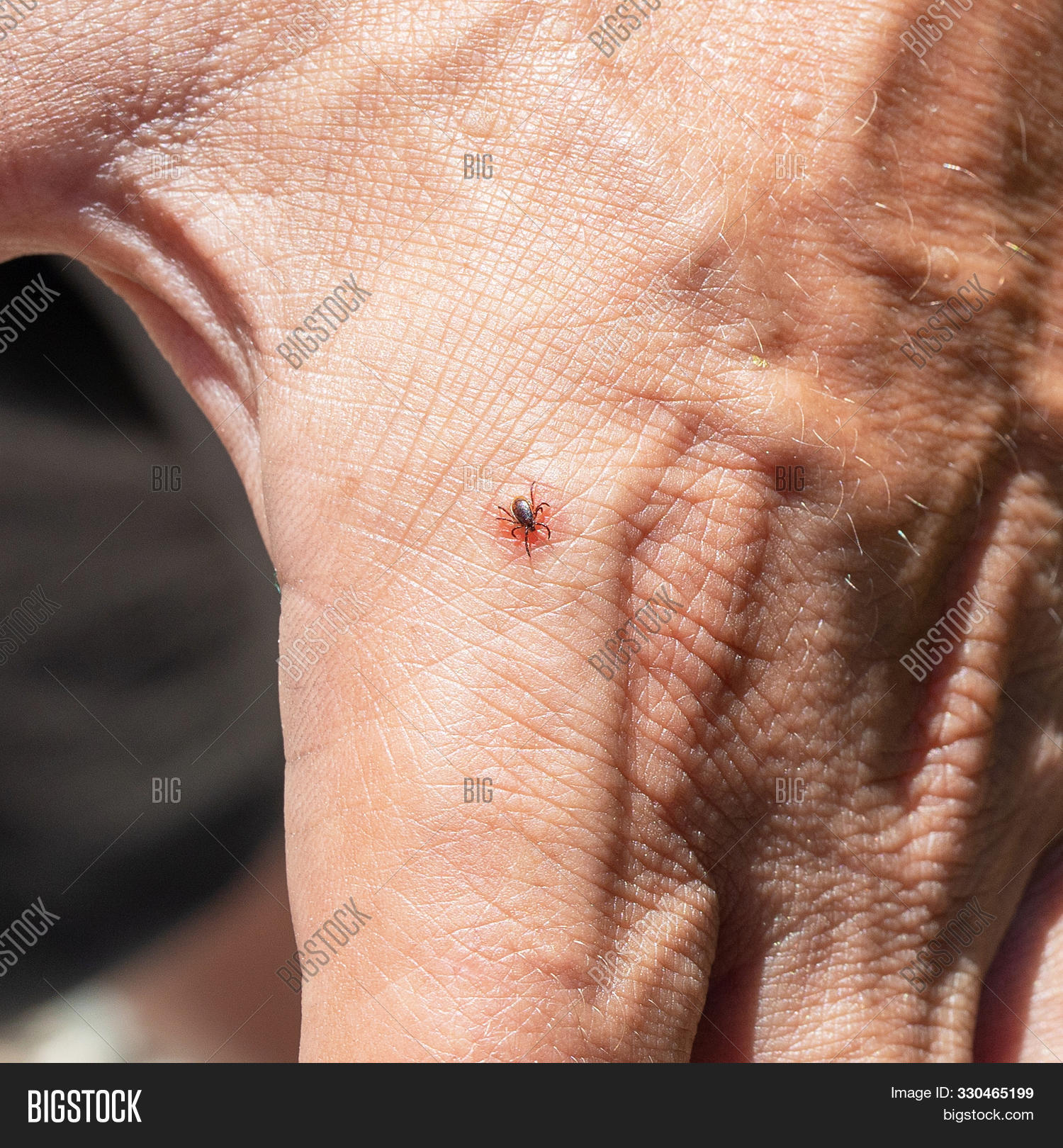Tick Bit Human Hand. Image & Photo (Free Trial) | Bigstock