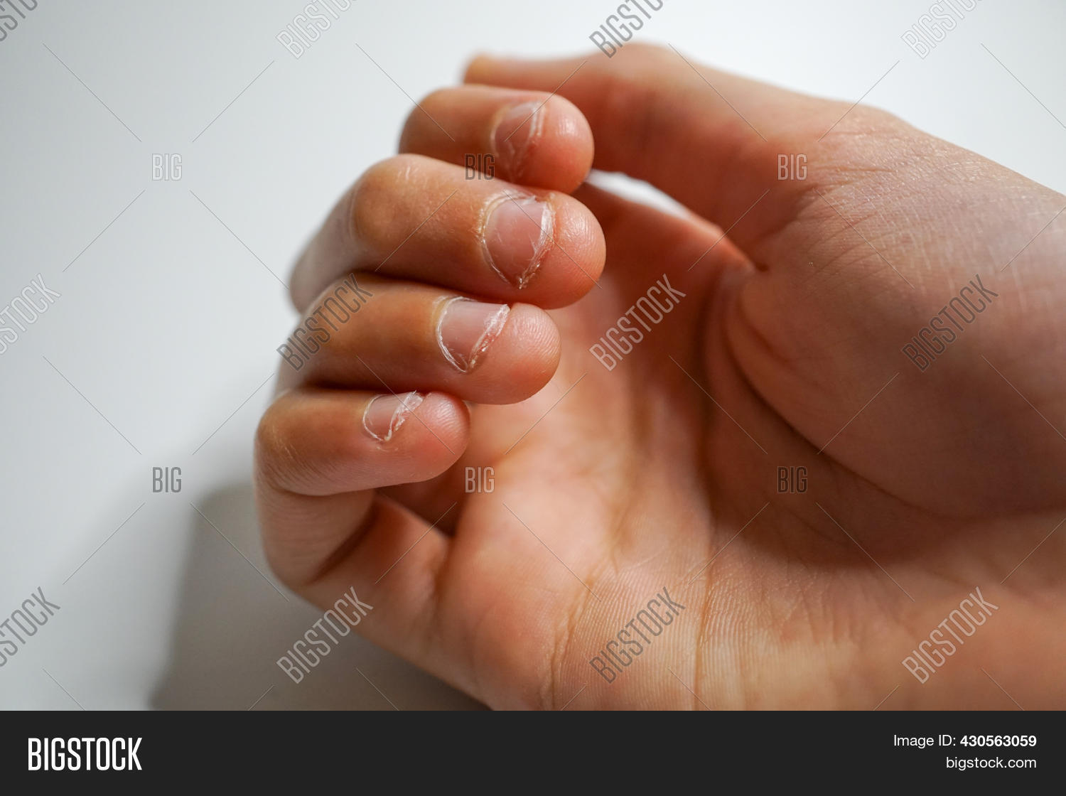Boys Hand Chewed Image & Photo (Free Trial) | Bigstock