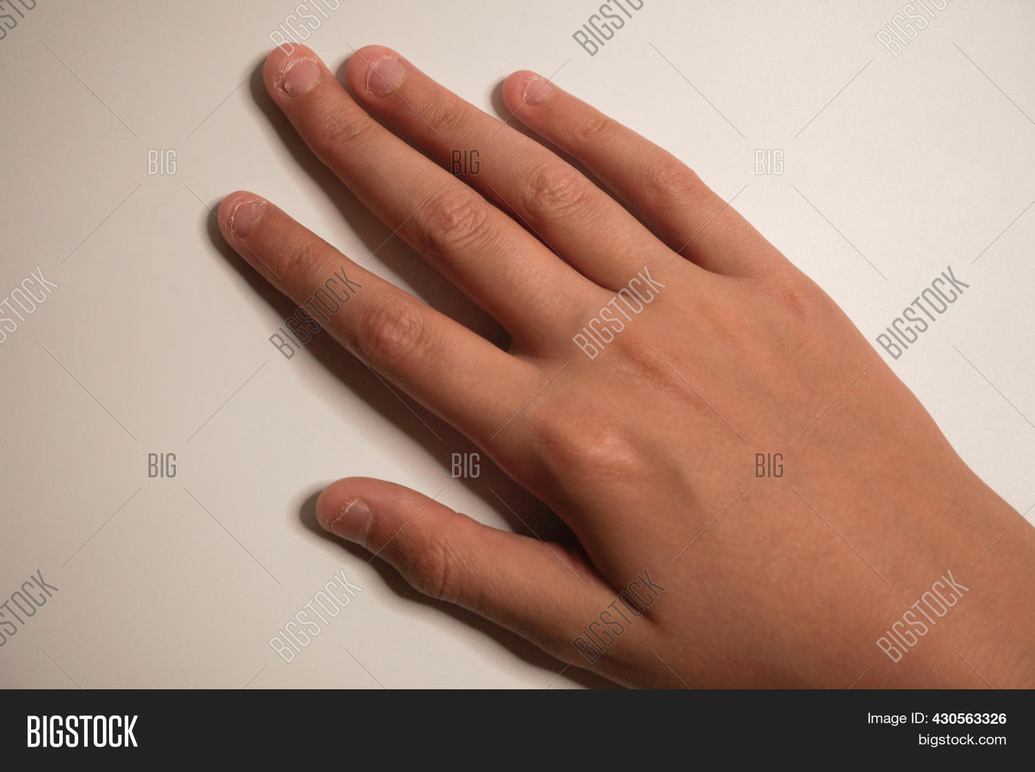 Boys Hand Chewed Image & Photo (Free Trial) | Bigstock