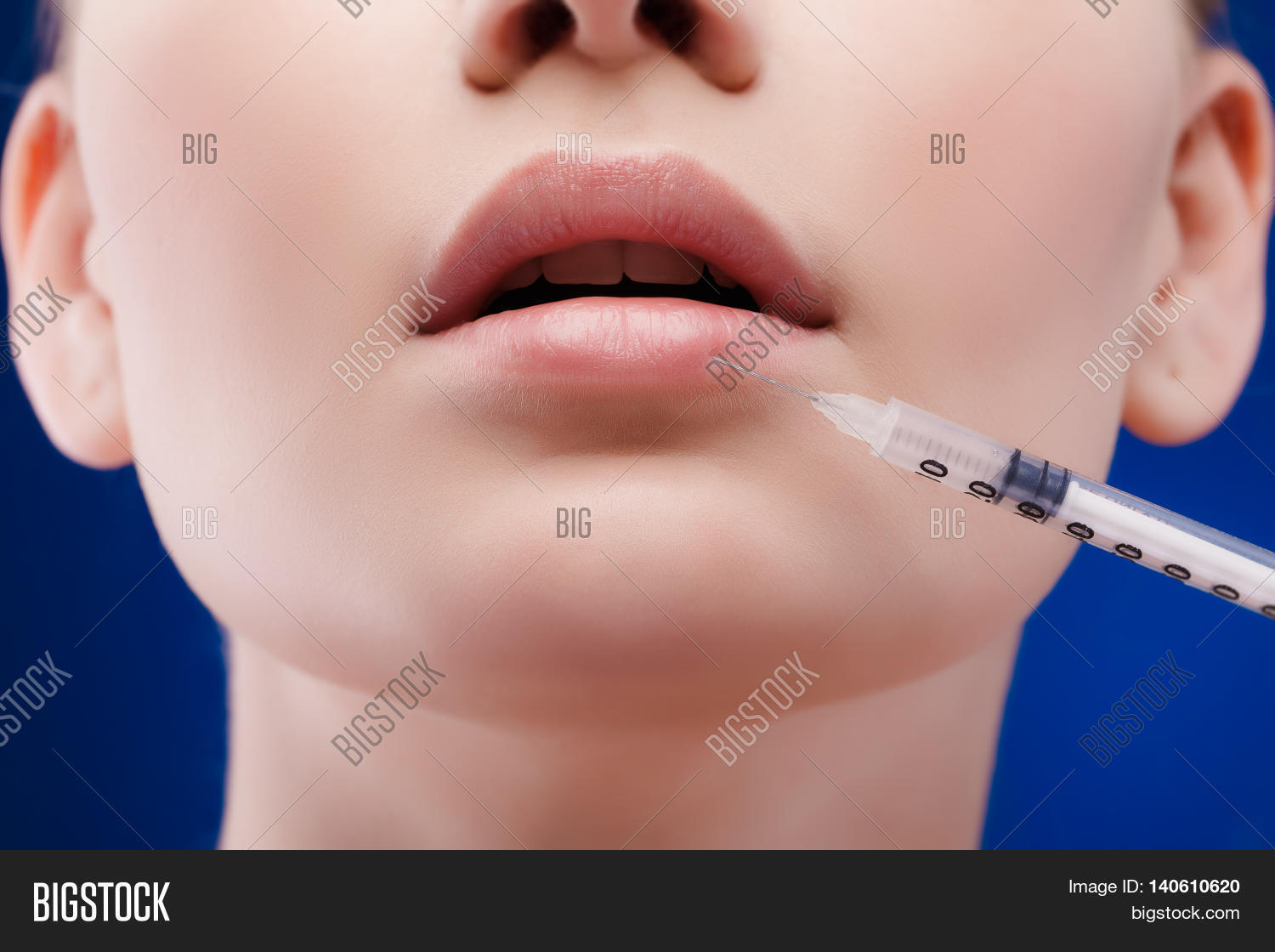 Beauty Woman Botox Image & Photo (Free Trial) | Bigstock