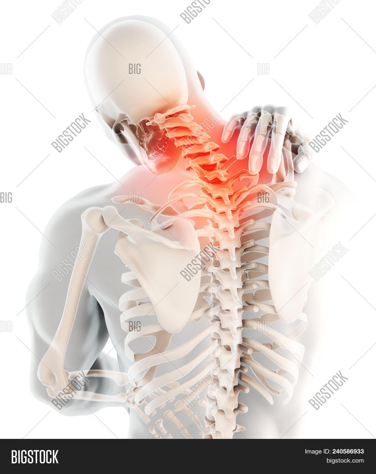 3d Illustration, Neck Image & Photo (Free Trial) | Bigstock