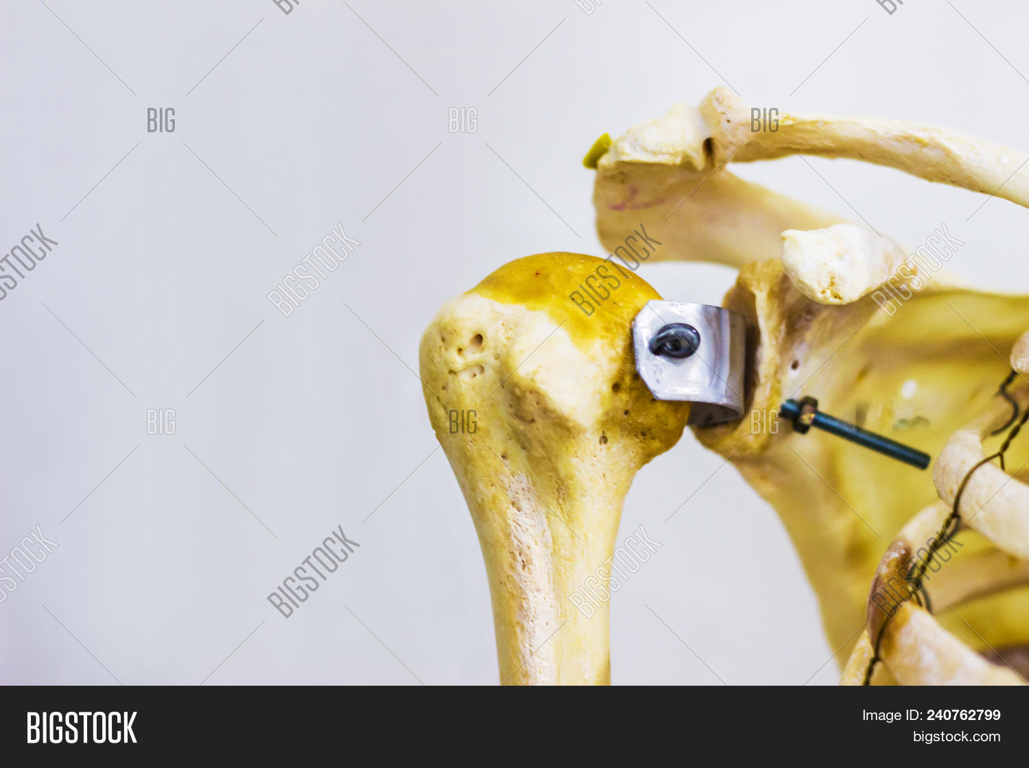 Articulated Humerus Image & Photo (Free Trial) | Bigstock
