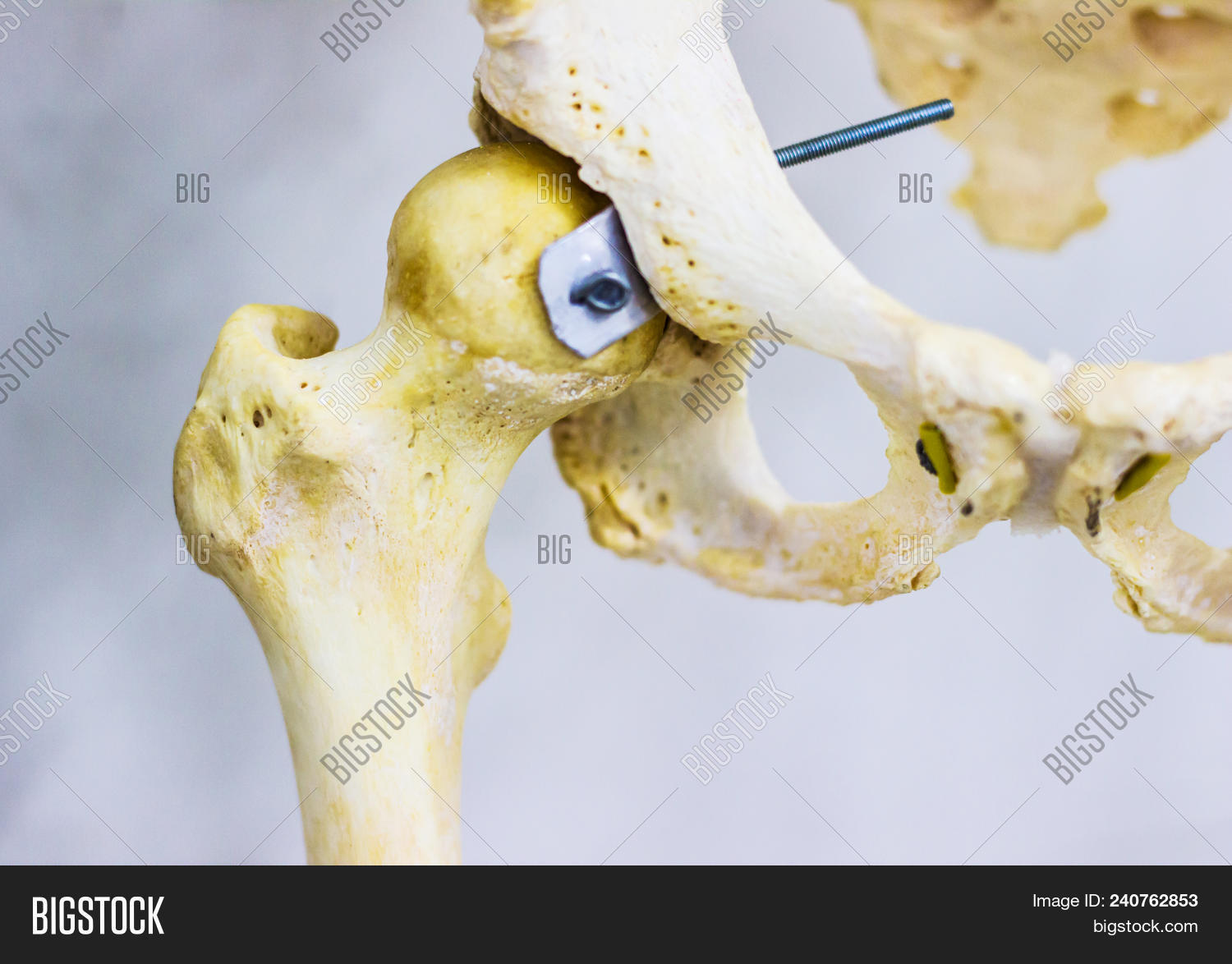 Articulated Hip Bone Image & Photo (Free Trial) | Bigstock