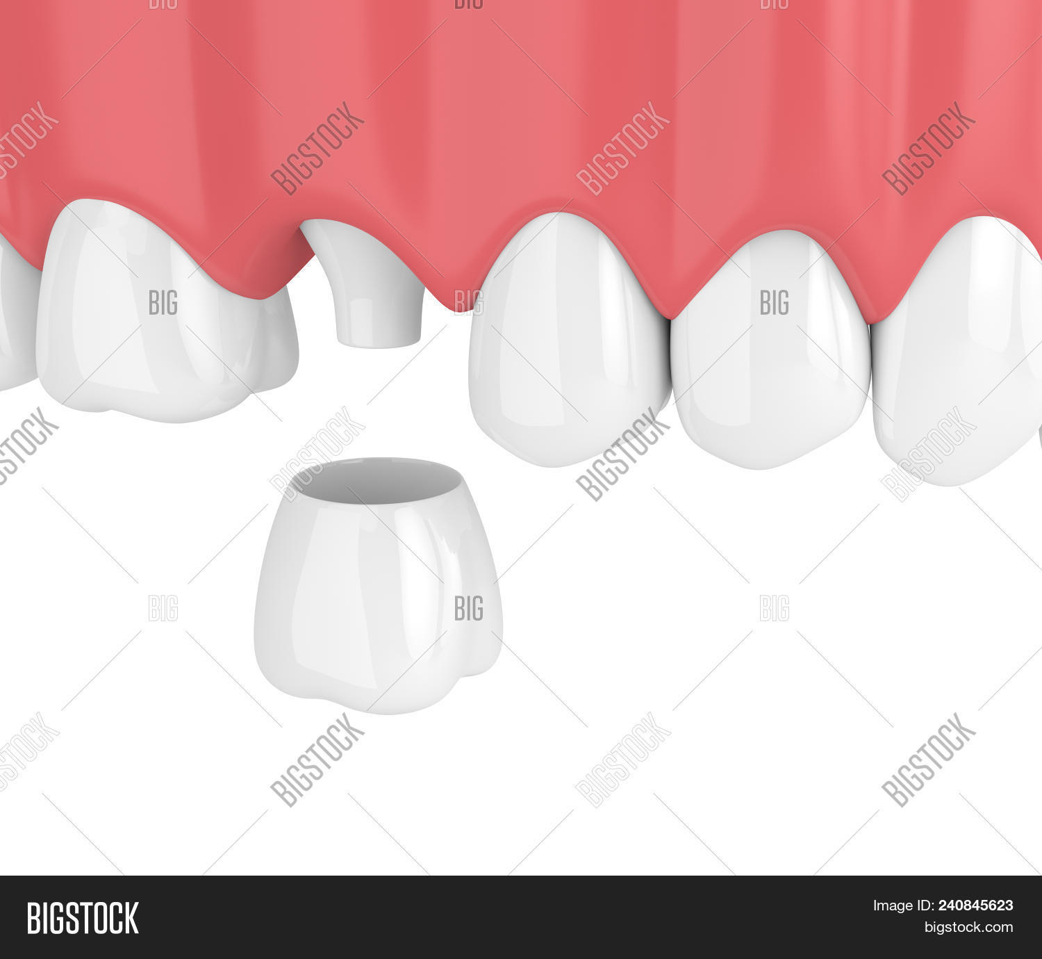 3D Render Upper Jaw Image & Photo (Free Trial) | Bigstock