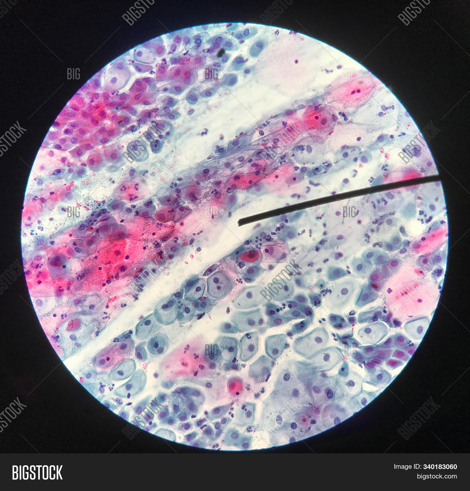 Cells Reproductive Image & Photo (Free Trial) | Bigstock