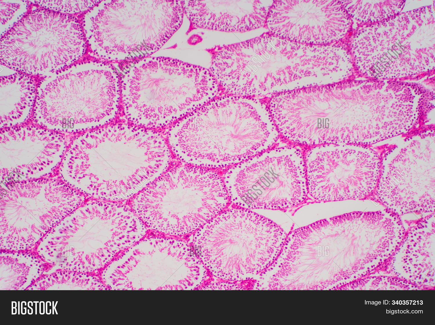 Human Sperm Testis Image & Photo (Free Trial) | Bigstock