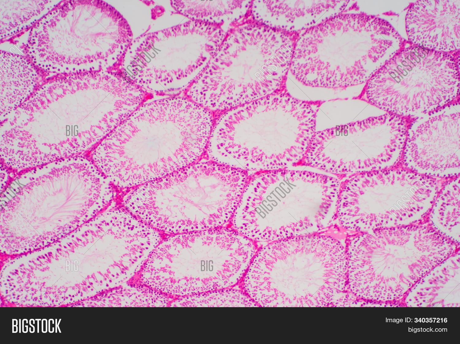 Human Sperm Testis Image & Photo (Free Trial) | Bigstock