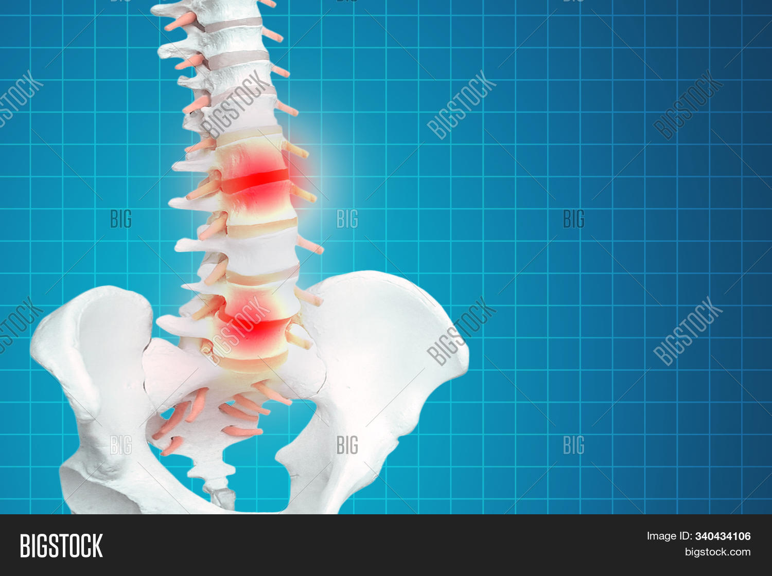 Realistic Skeletal Image & Photo (Free Trial) | Bigstock