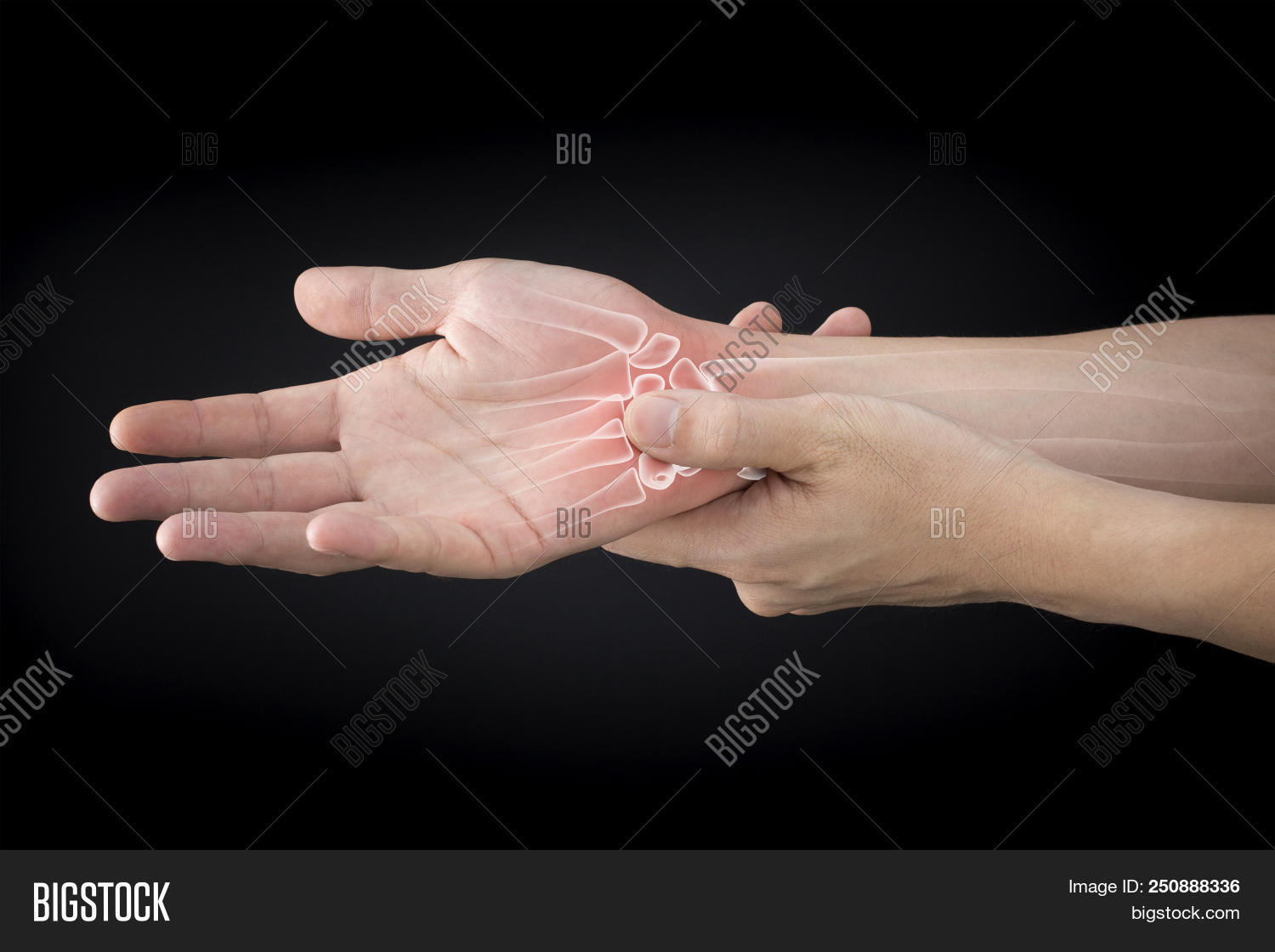 Wrist Bones Injury Image & Photo (Free Trial) | Bigstock