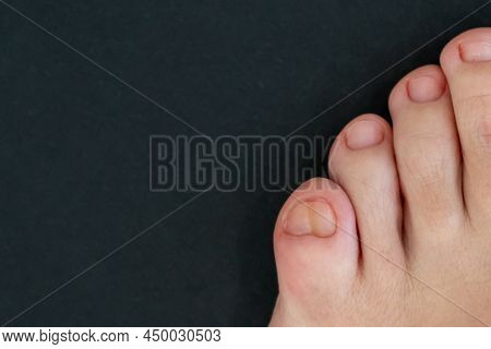 ภาพและภาพถ่าย (ทดลองใช้ฟรี) | Bigstock