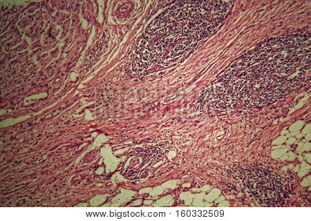 Cells Human Stomach Image & Photo (Free Trial) | Bigstock