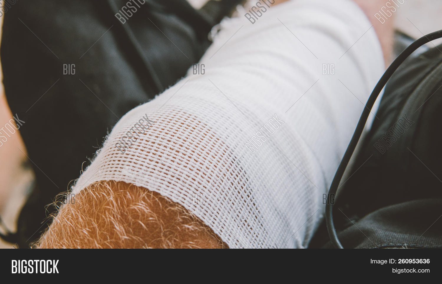 Bandaged Leg After Image & Photo (Free Trial) | Bigstock