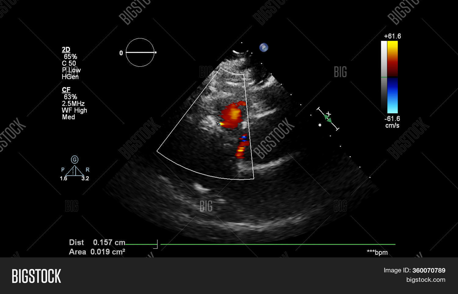 Image Heart Gray-scale Image & Photo (Free Trial) | Bigstock