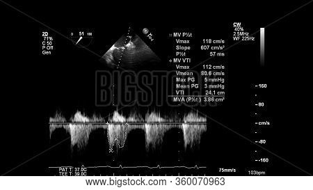 Image Heart Gray-scale Image & Photo (Free Trial) | Bigstock
