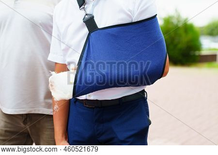 Man Broken Arm Cast. Image & Photo (Free Trial) | Bigstock