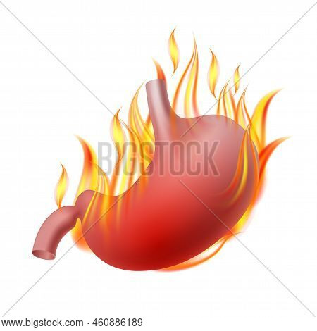 Burning Stomach. Vector & Photo (Free Trial) | Bigstock