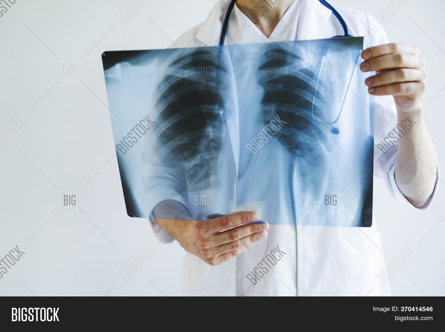Doctor Holding X-ray Image & Photo (Free Trial) | Bigstock