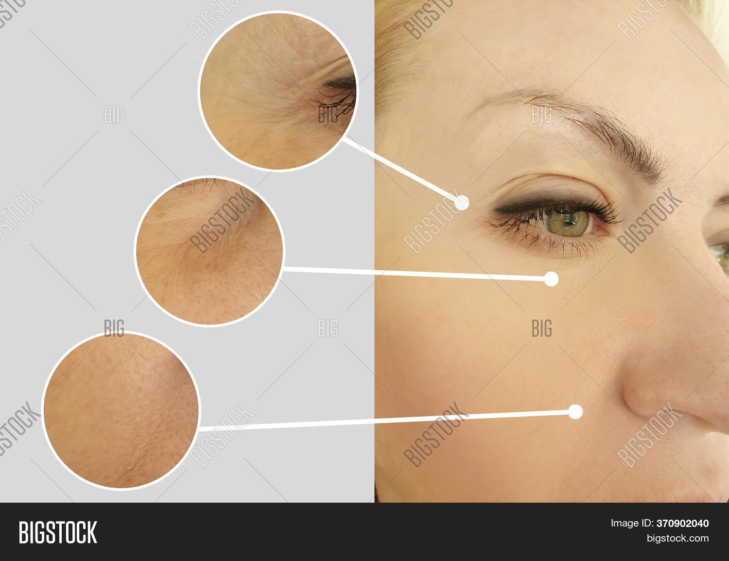 Woman Face Wrinkles Image & Photo (Free Trial) | Bigstock