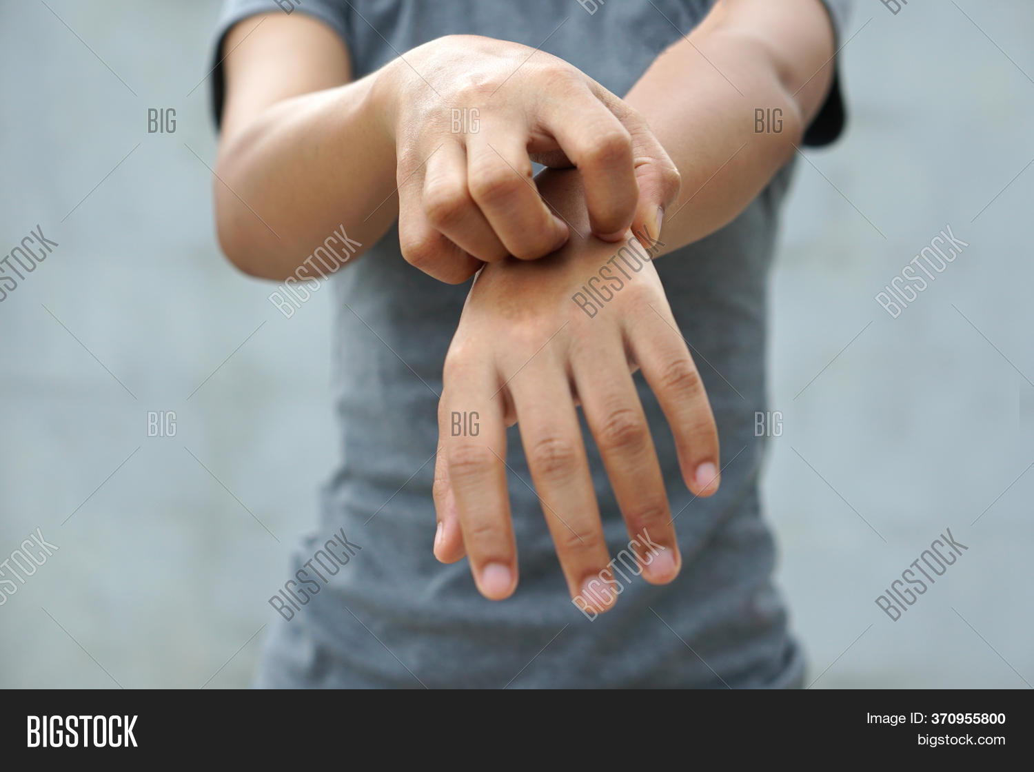 Woman Scratching Arm Image & Photo (Free Trial) | Bigstock
