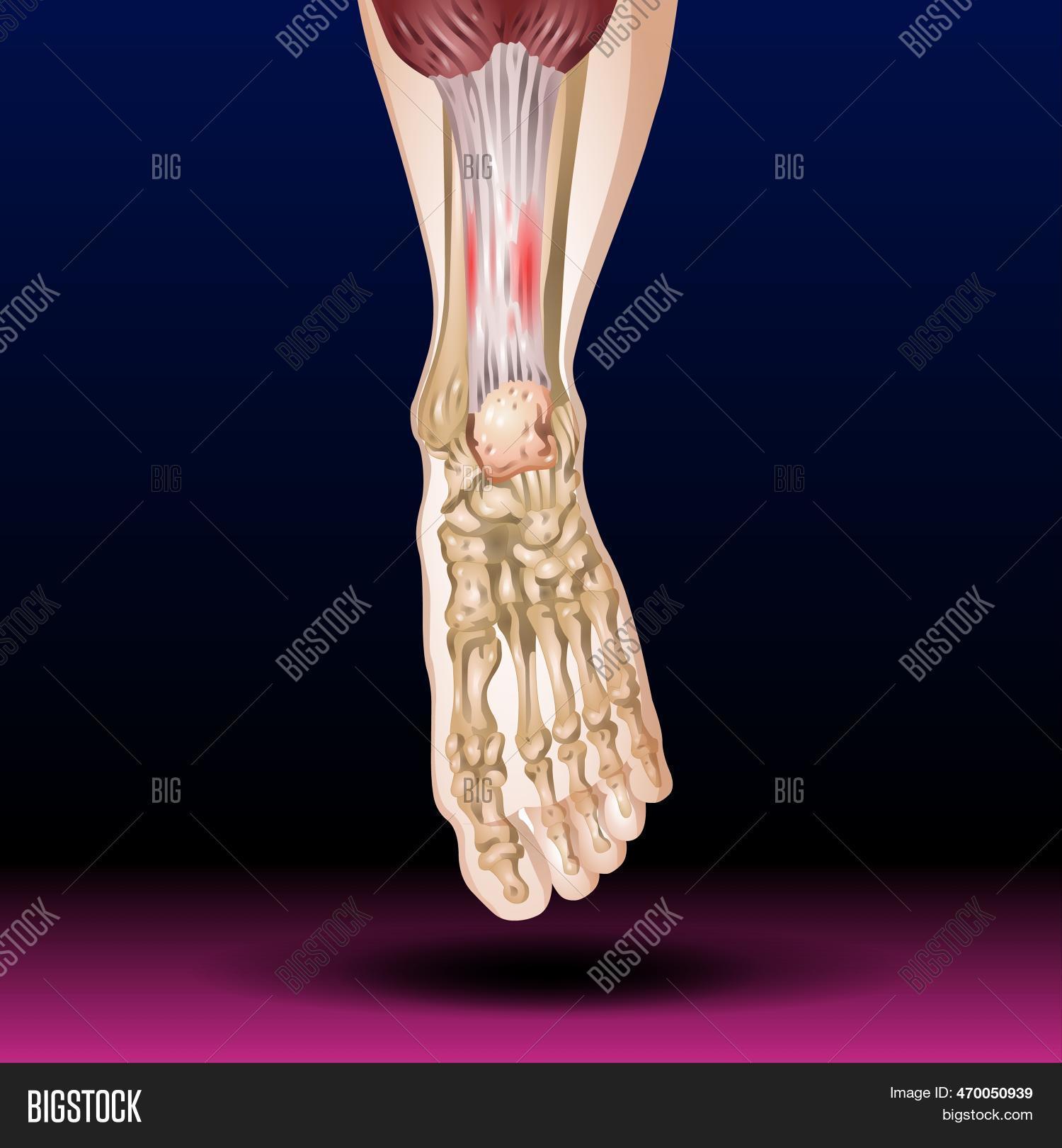 Human Front Leg Bone Image & Photo (Free Trial) | Bigstock