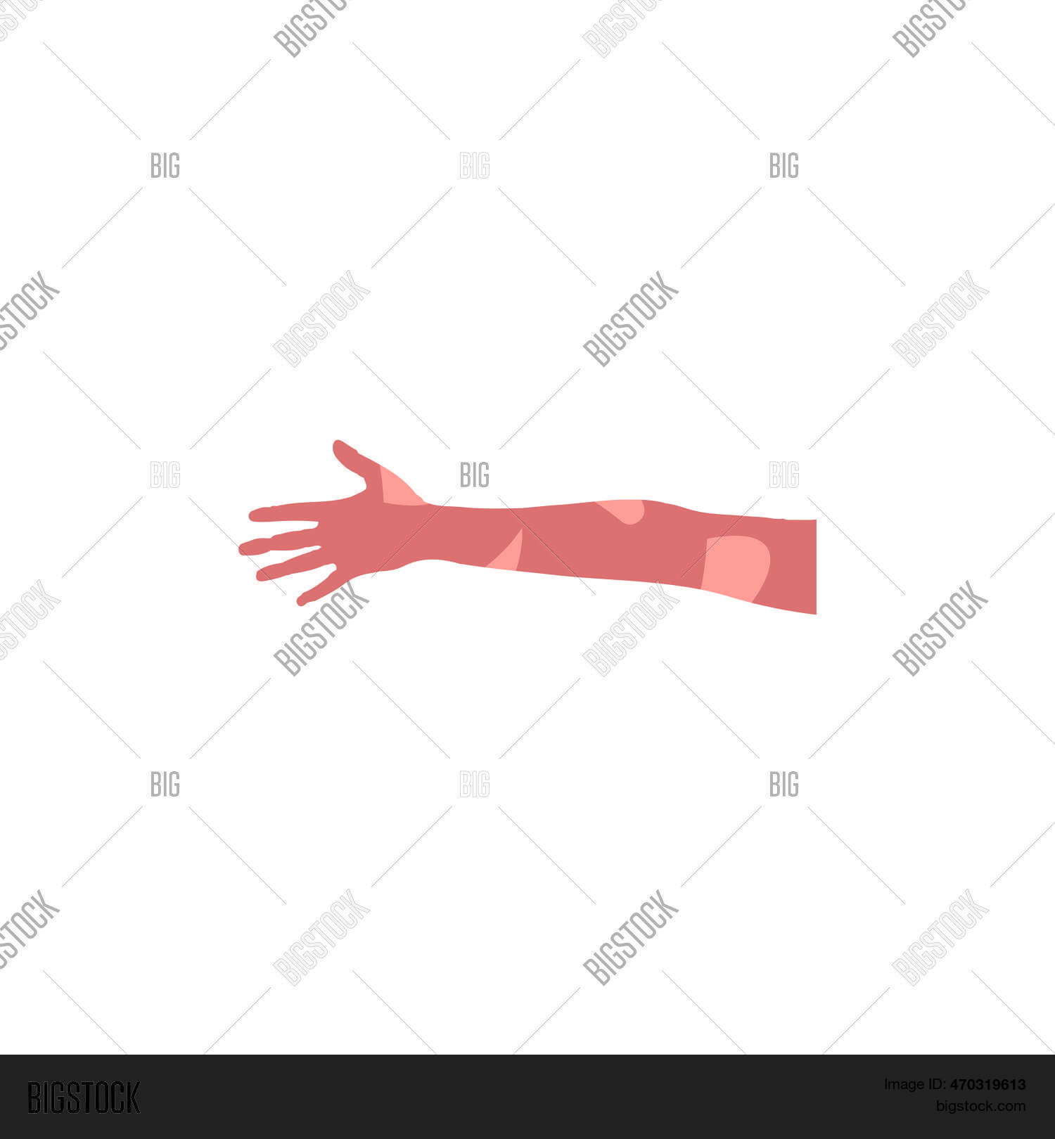 Leprosy Icon. Simple Vector & Photo (Free Trial) | Bigstock