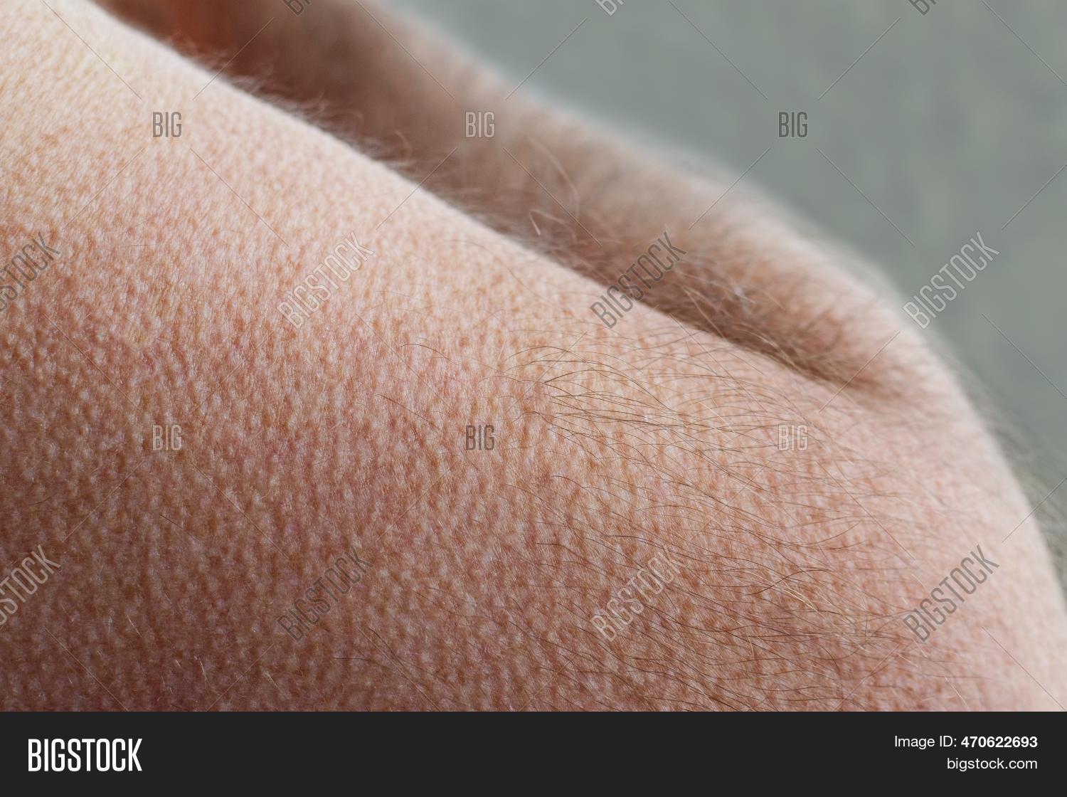 Goose Bumps - Human Image & Photo (Free Trial) | Bigstock