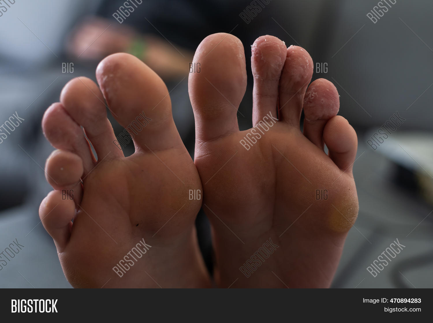 Mans Toes Showing What Image & Photo (Free Trial) | Bigstock