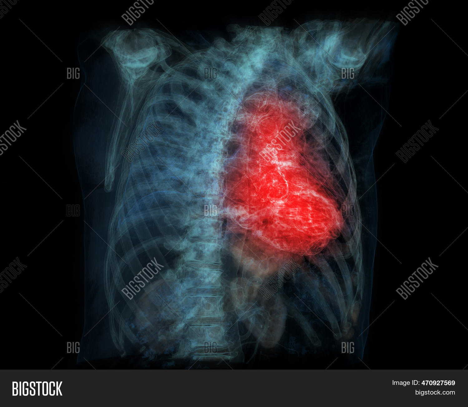 Human Heart Attack Image & Photo (Free Trial) | Bigstock