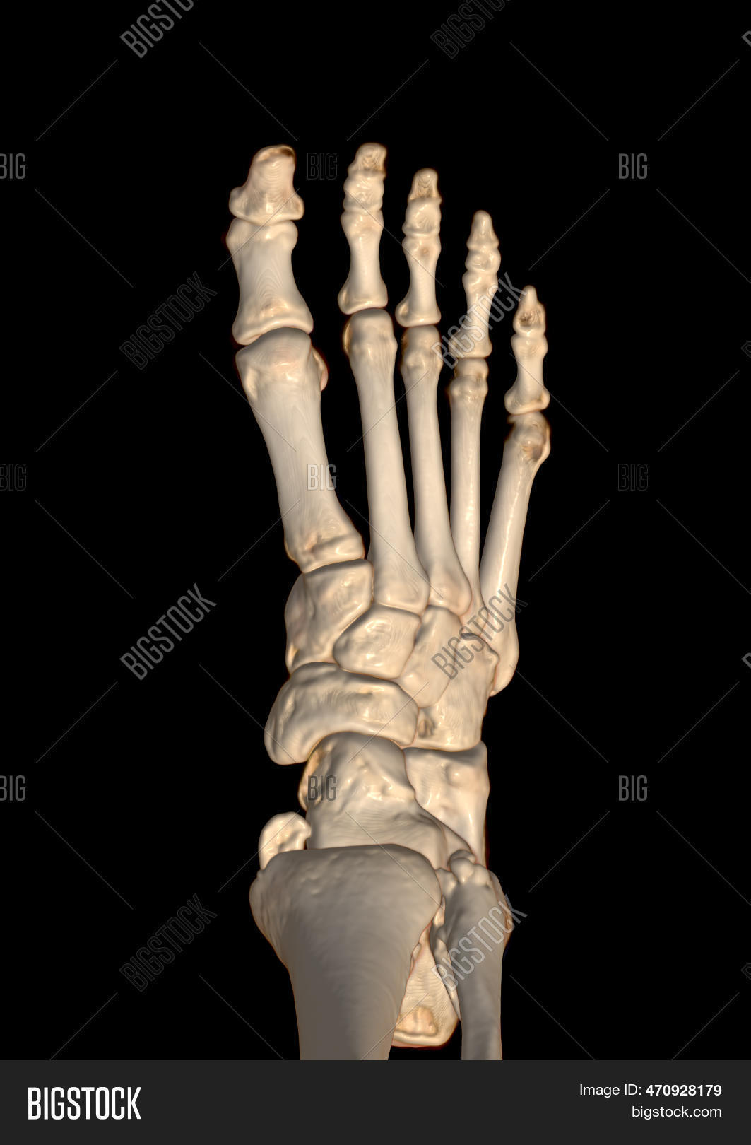 Ct Scan Ankle Foot Image & Photo (Free Trial) | Bigstock