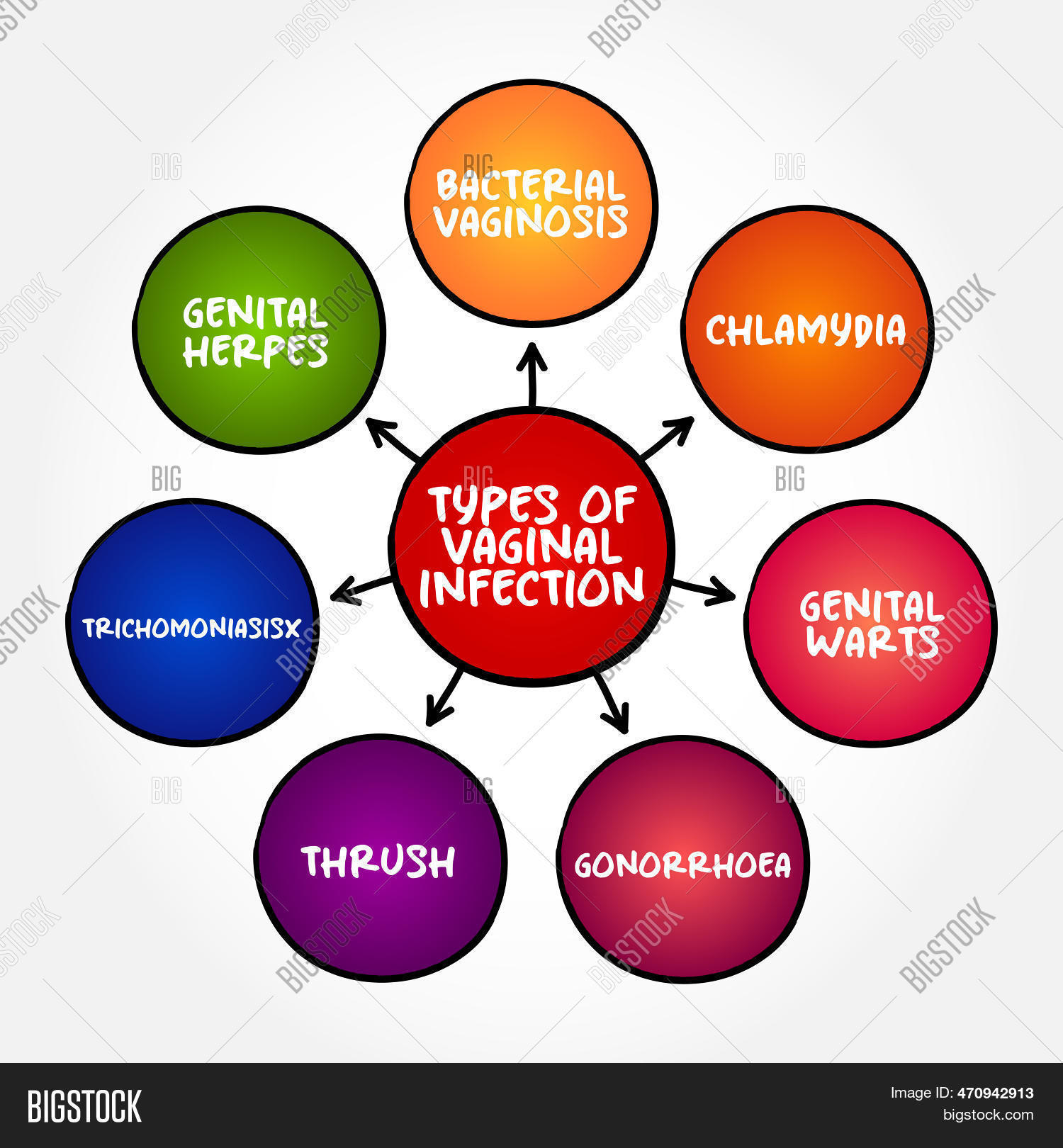 Types Vaginal Image & Photo (Free Trial) | Bigstock
